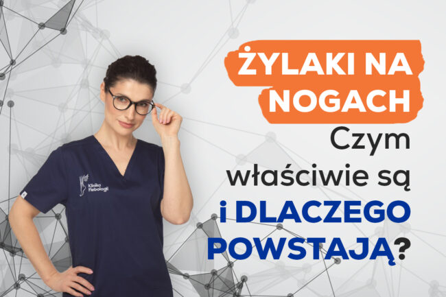 Żylaki na nogach – czym właściwie są i dlaczego powstają? | Dr Venus ...